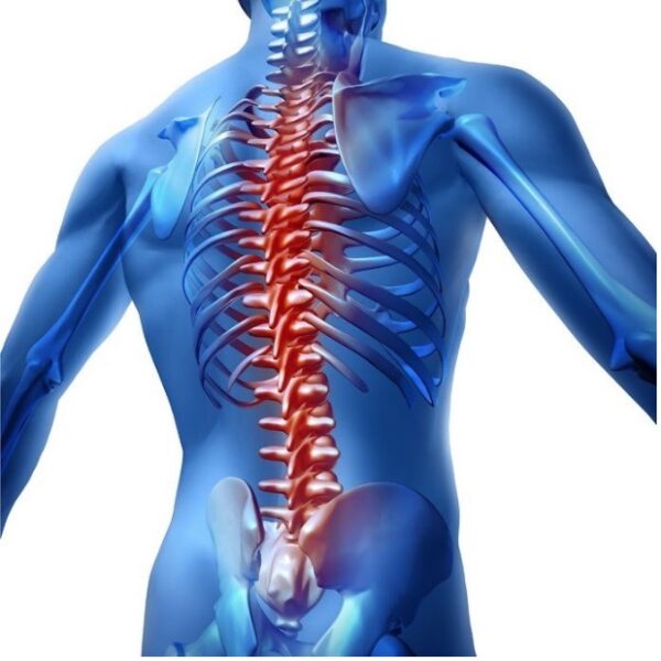 Lumbar Facet Pain - Physicians Pain Services